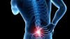 Back Soreness After Deadlifts...Is It Normal?