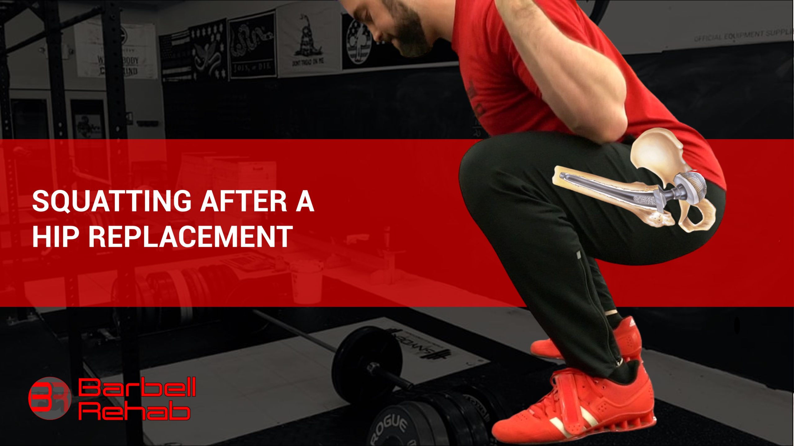 Best Hip Replacement For Athletes Liebermann mezquita